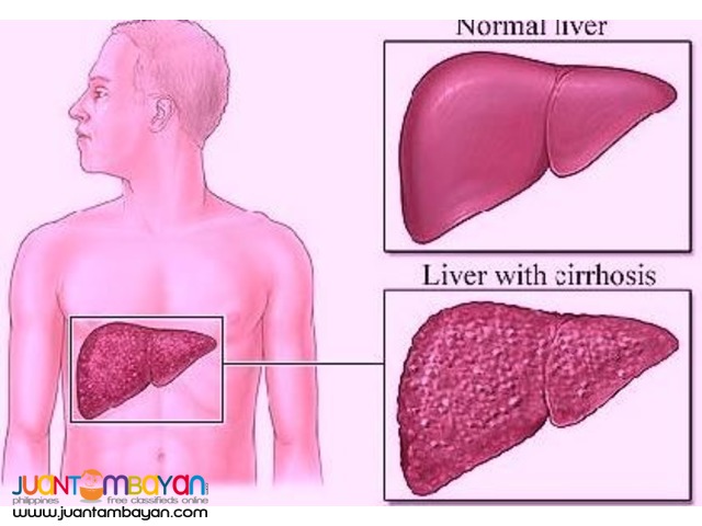 How to Cure your Sickness